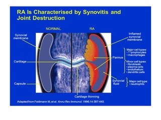 Rheumatoid arthritis clinical presentation pathology pptx | PPT