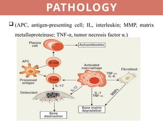 Rheumatoid arthritis clinical presentation pathology pptx | PPTX