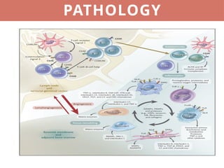 Rheumatoid arthritis clinical presentation pathology pptx | PPTX