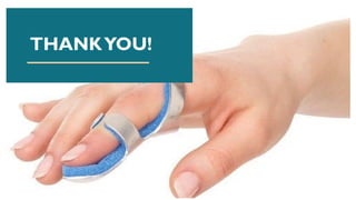 Upper Extremity Splinting for Rheumatoid Arthritis | PPTX