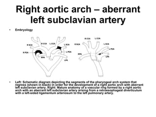 Vascular fetal anomaly -aortic arch anomalies | PPT | Heart and ...