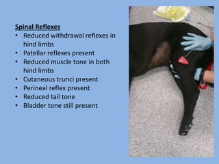 Meningiomyelitis | PPTX | Brain and Nervous System Disorders | Diseases ...