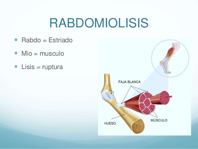 Rabdomiolisis