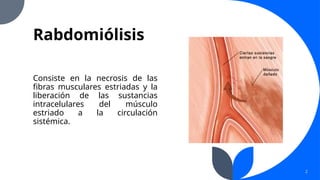 Rabdomiolisis y sindrome compartimental.pptx