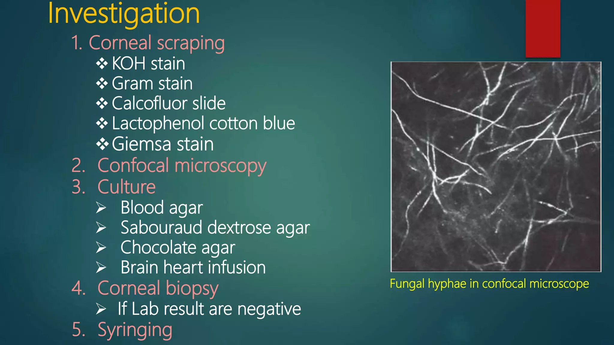 fungal / mycotic corneal ulcer power point presentation for O.A 2nd ...