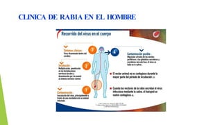 Vías de transmisión de la rabia y sus portadores | PPTX