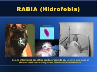 Rabia | PPT