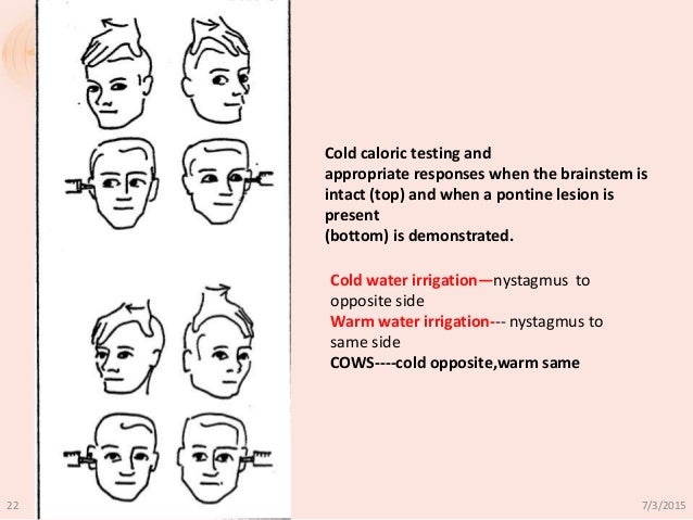 Localization of CNS lesions
