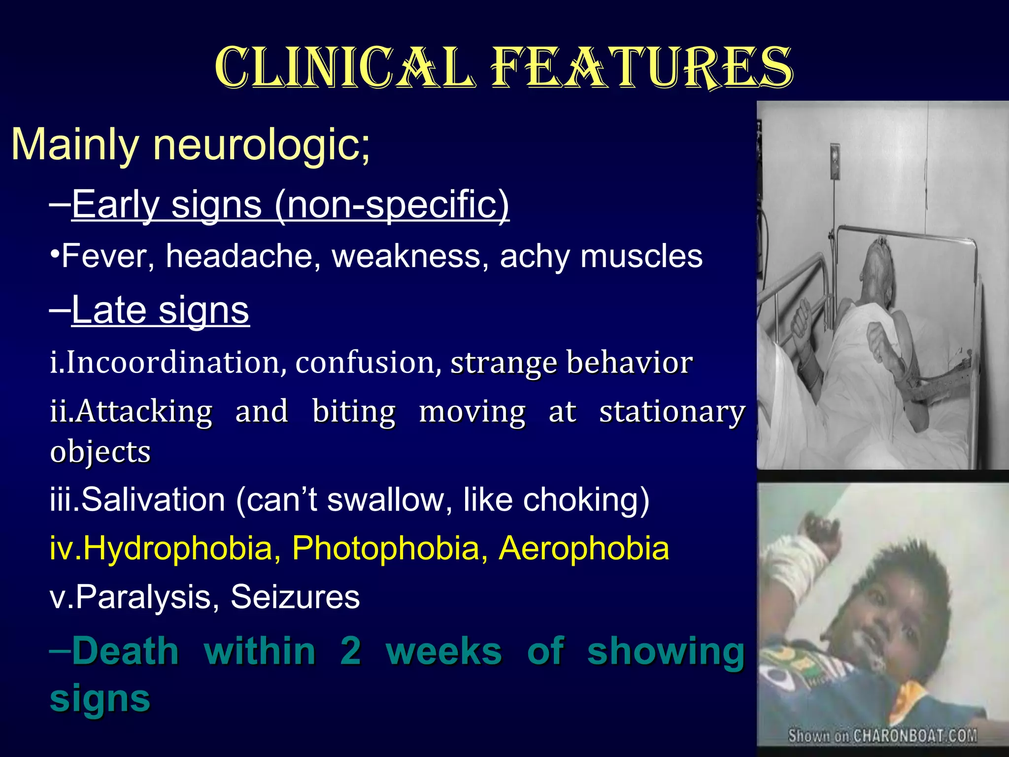 Rabies: Considerations to Nursing | PPT