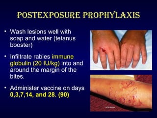 Rabies | PPT