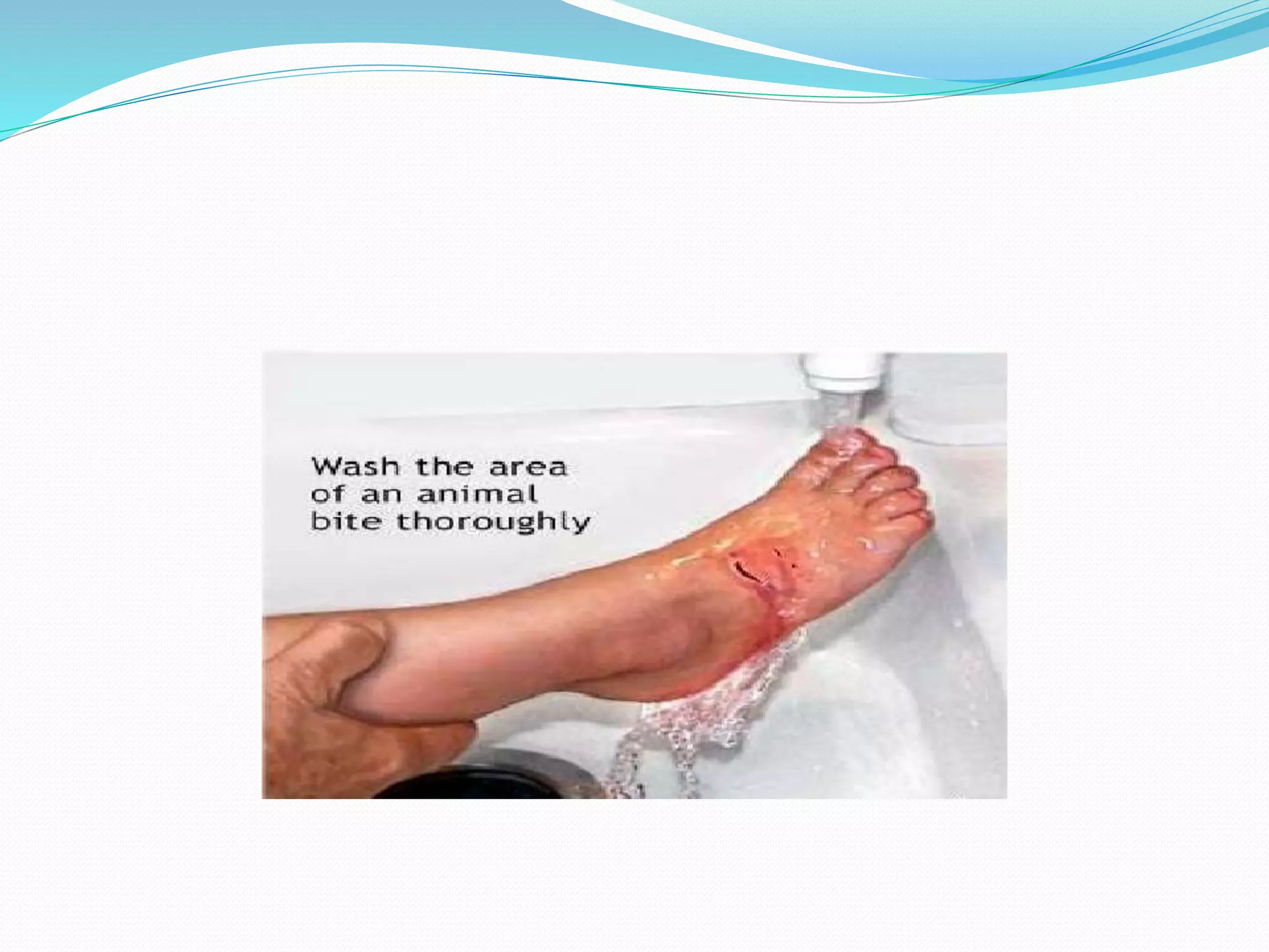 Rabies Powerpoint Presentation aerophobia, dog bite prophylaxis ...