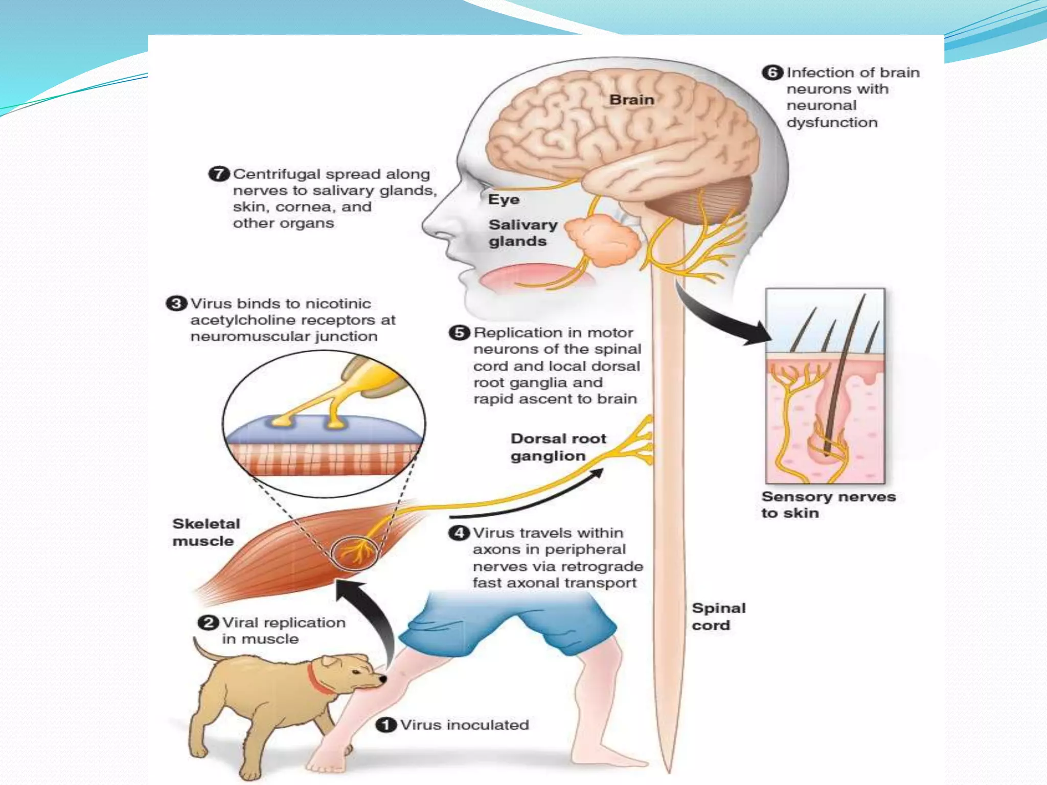 Rabies Powerpoint Presentation aerophobia, dog bite prophylaxis ...