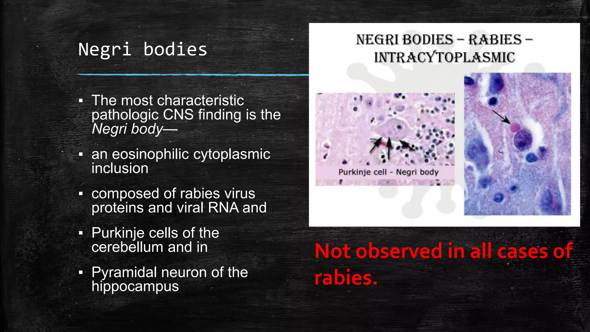 Rabies | PPTX