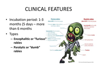 Rabies | PPTX