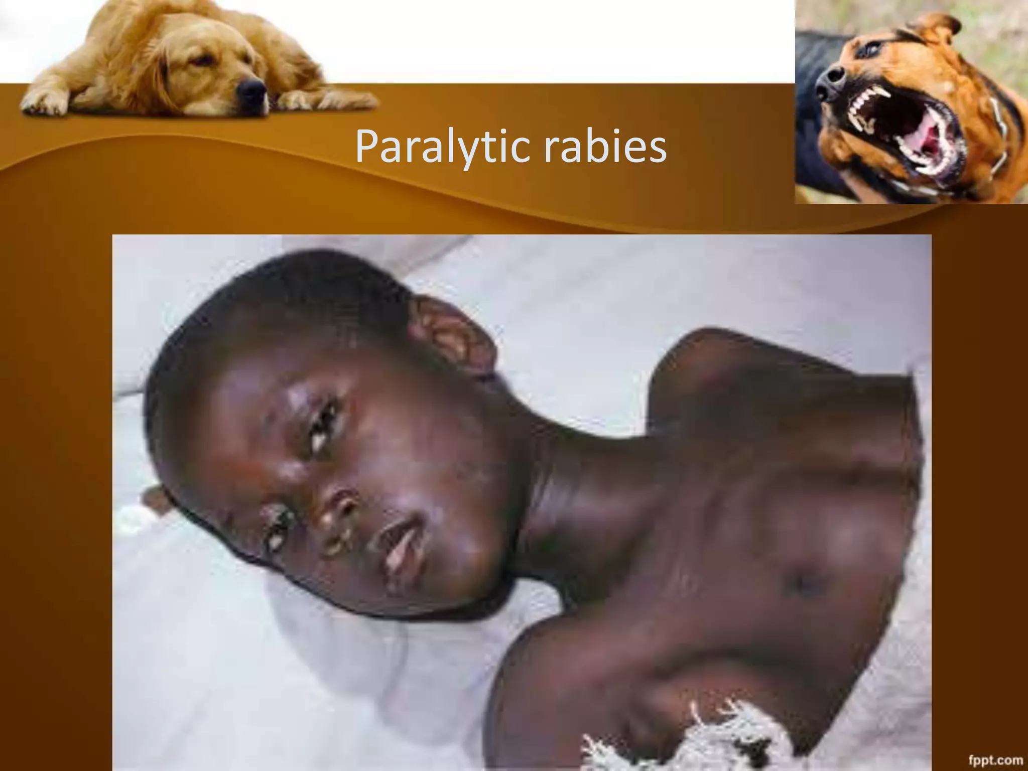 Rabies by Dr. Rakesh Prasad Sah | PPTX