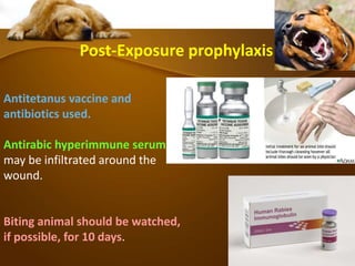 Rabies by Dr. Rakesh Prasad Sah | PPTX