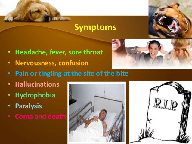 Rabies by Dr. Rakesh Prasad Sah