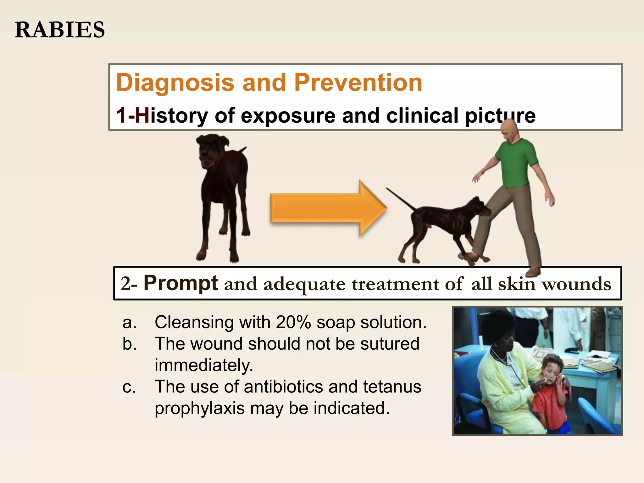 Rabies.ppt