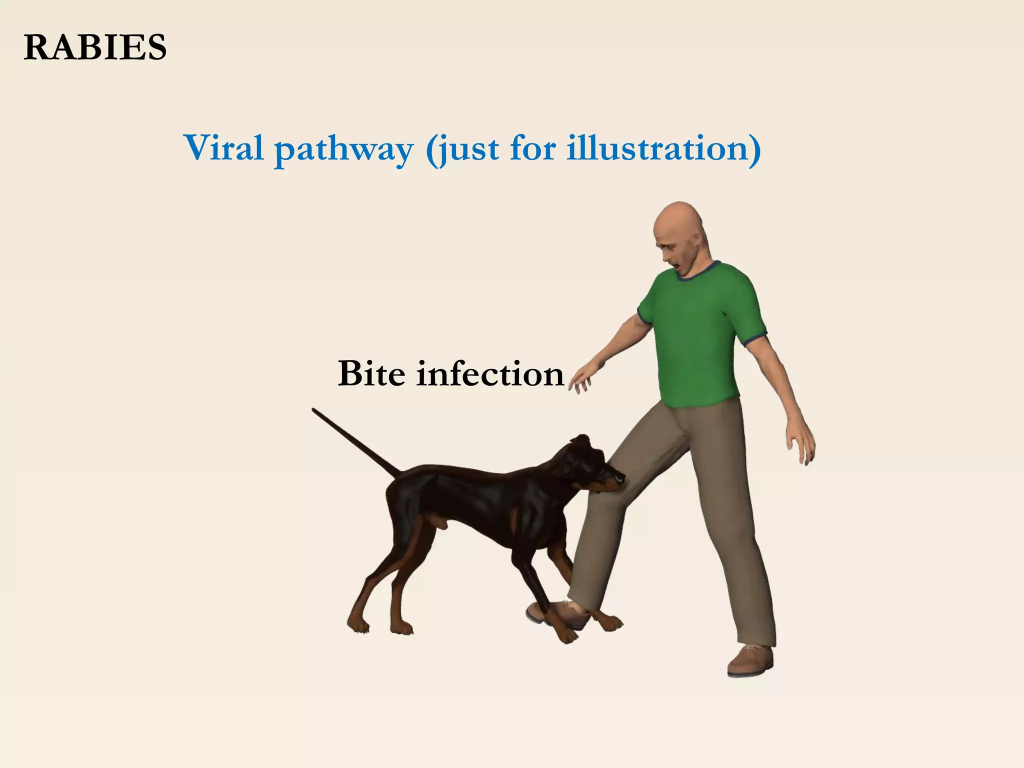 Rabies.ppt