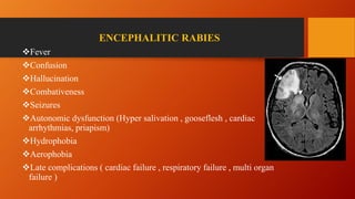 RABIES.pptx | Infectious Diseases | Diseases and Conditions