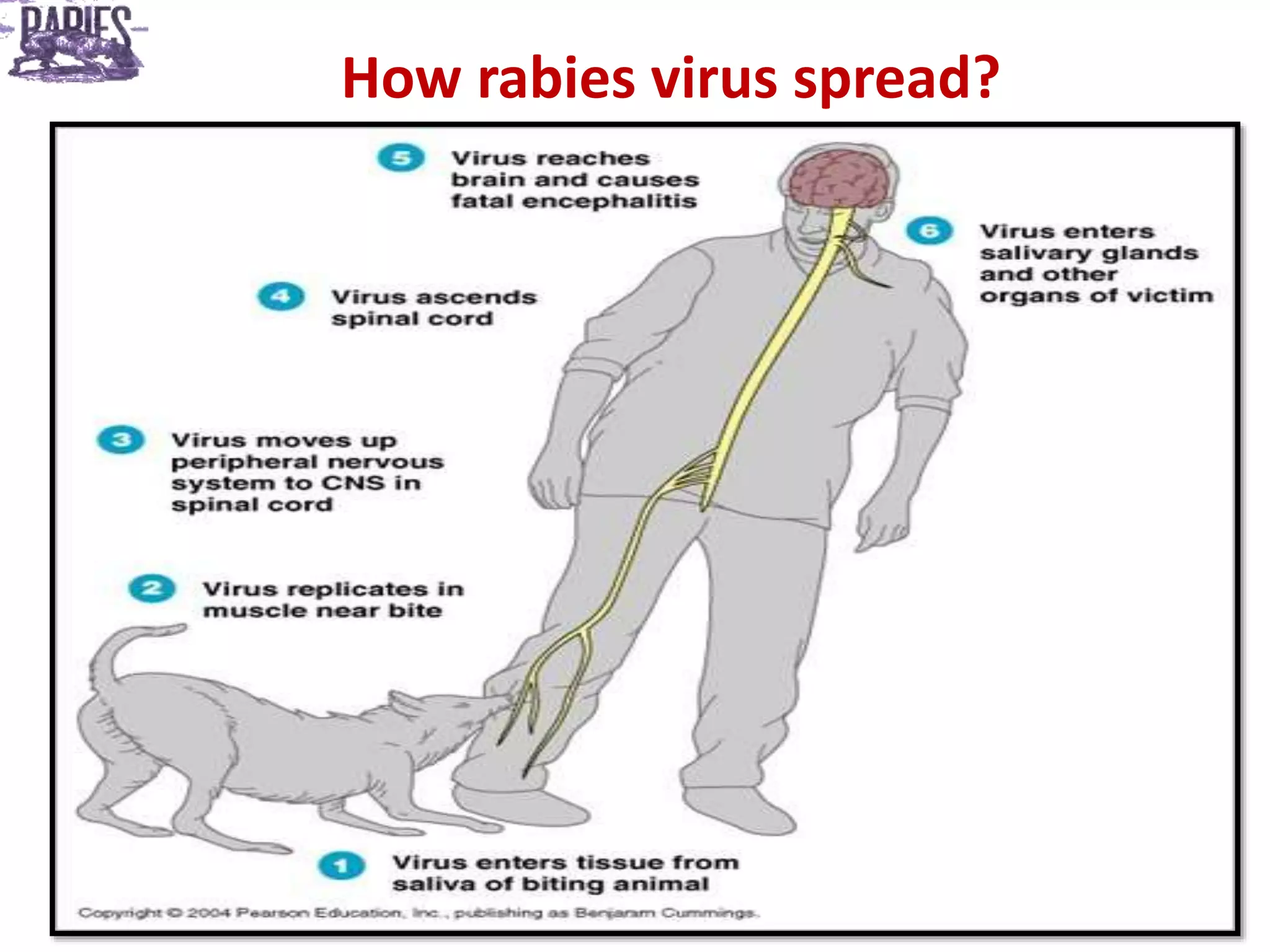 Rabies: The Most Fatal Disease.pptx