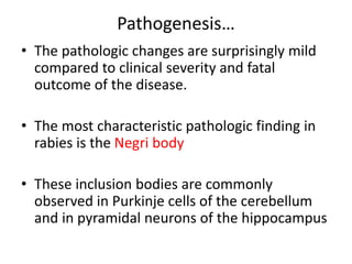 Rabies.pptx(Epidemiology,pathophysiology.clinical features and ...