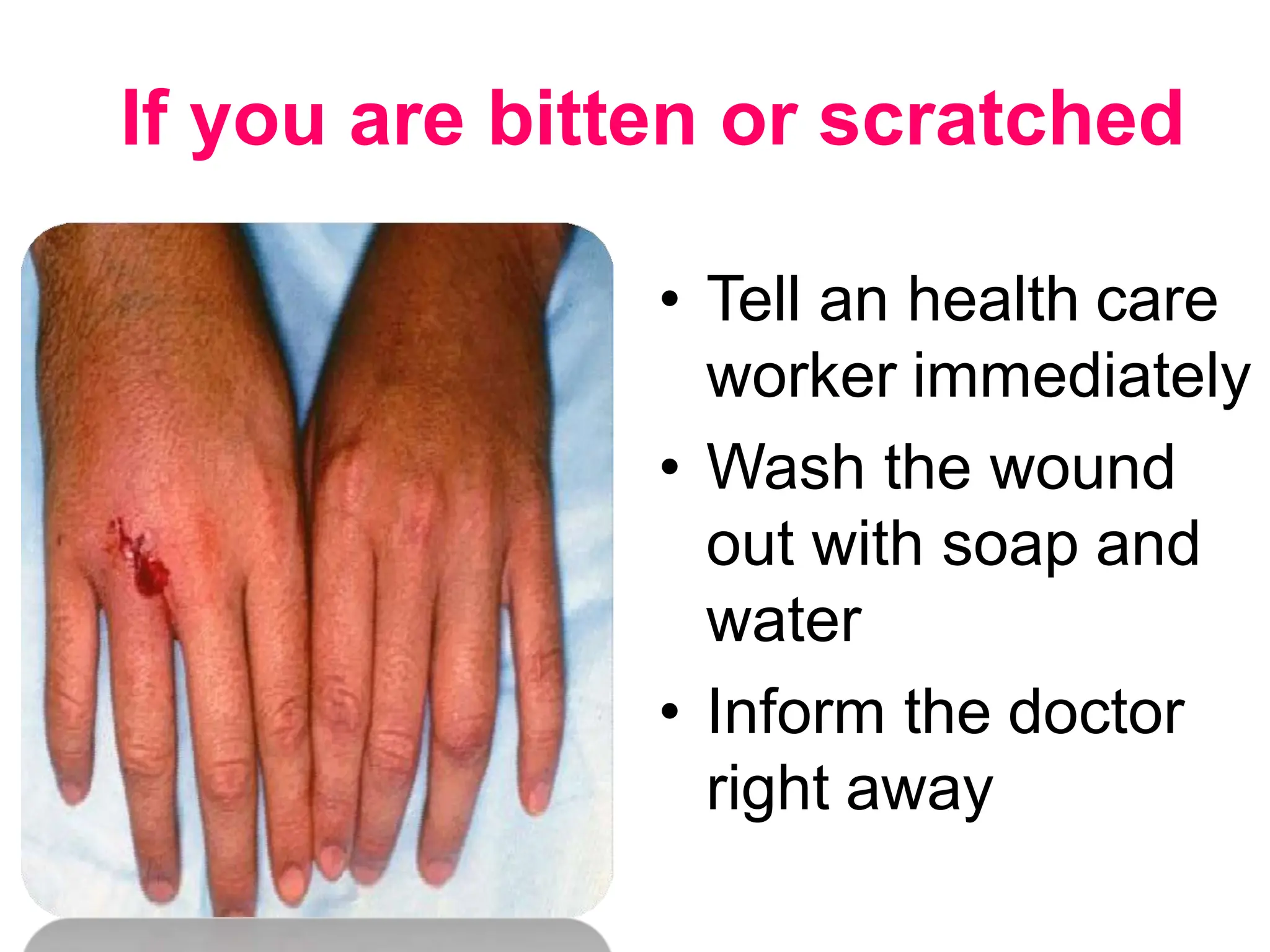 Morphology of Rabies virus and its clinical significance.pptx ...