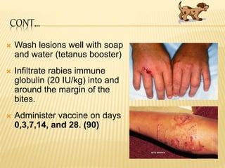 rabies, definition, introduction, diagnosis.pptx