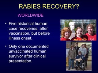 Rabies. The presentation for community medicine | PDF