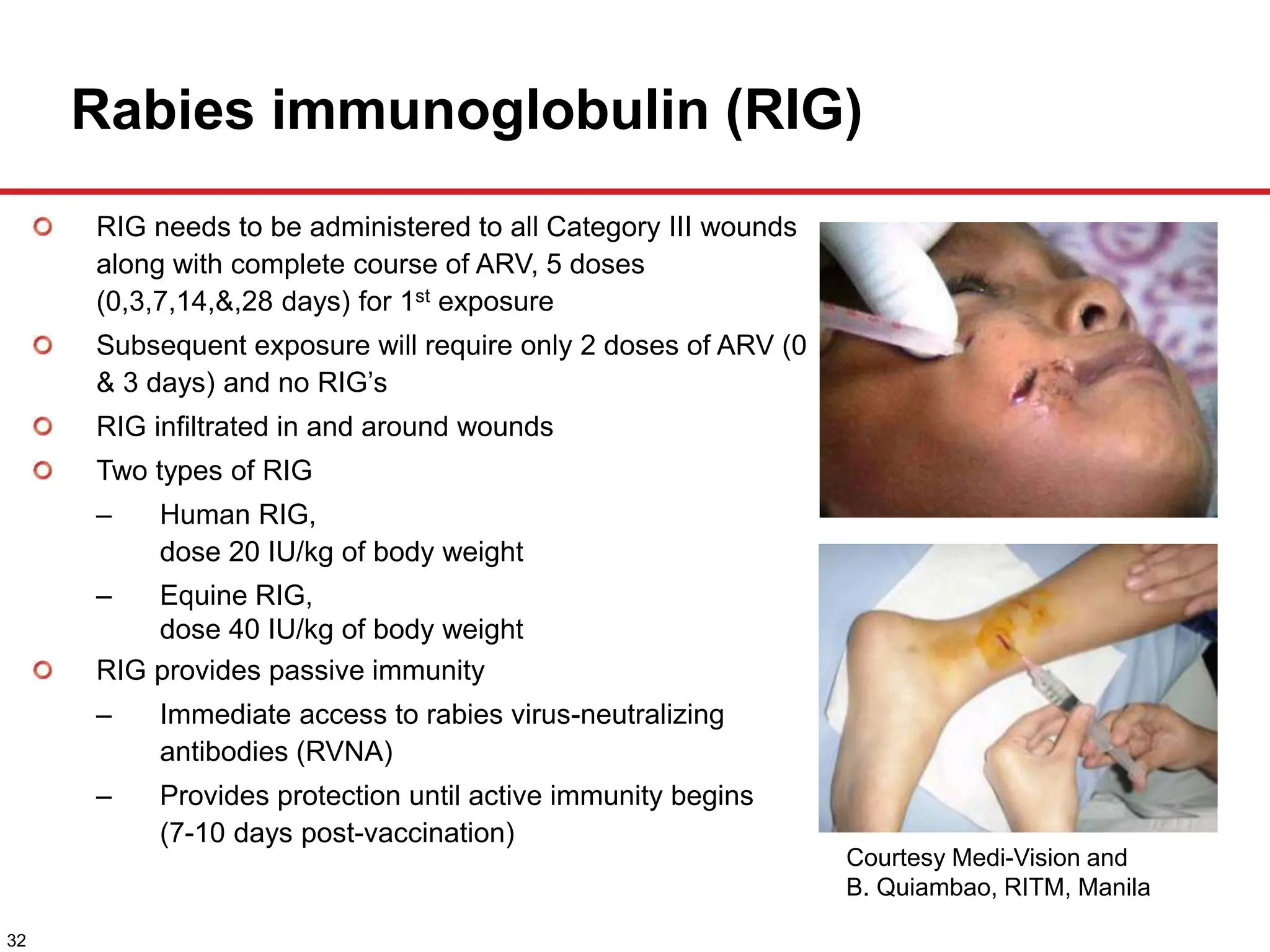 Rabies.ppt by professor Dr Nirmal sahani | PPT