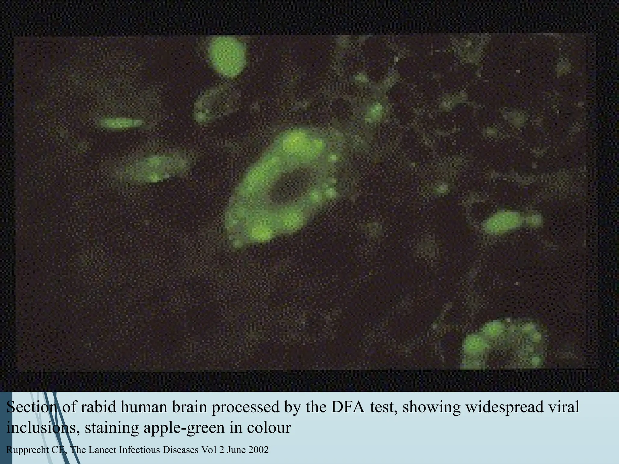 Rabies virus and complete description.ppt