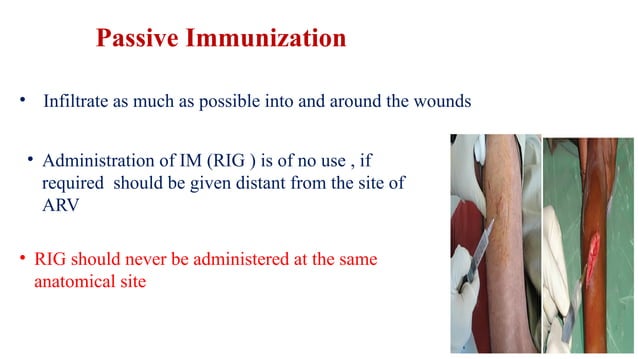 RABIES-etiopathogenesis, prevention and management.pptx