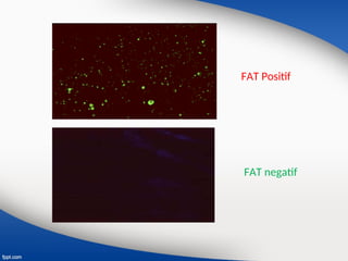 Penanganan pencegahan tatalaksana Rabies.ppt