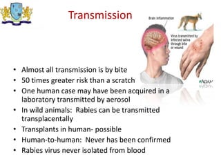 Rabies jsk nagarajan | PPT