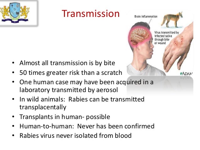 Rabies jsk nagarajan
