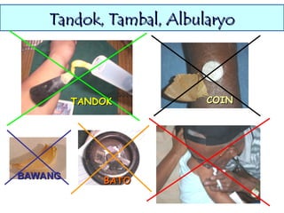kaalaman tungkol sa rabies-powerpoint.ppt
