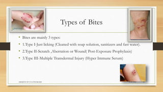 Rabies | PPTX | Infectious Diseases | Diseases and Conditions