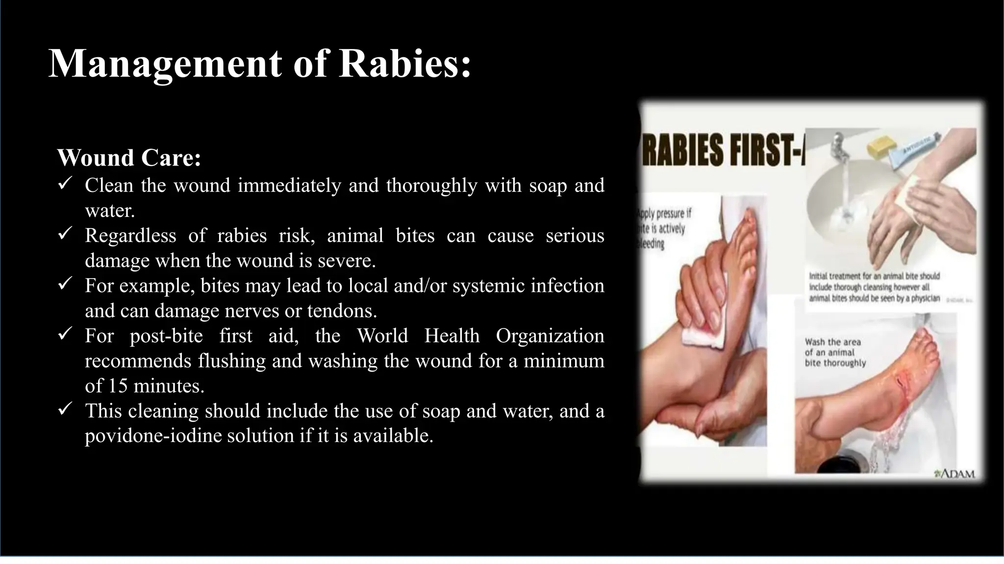 Rabies Clinical Disease Mangement By Waqas Siddiqe.pptx