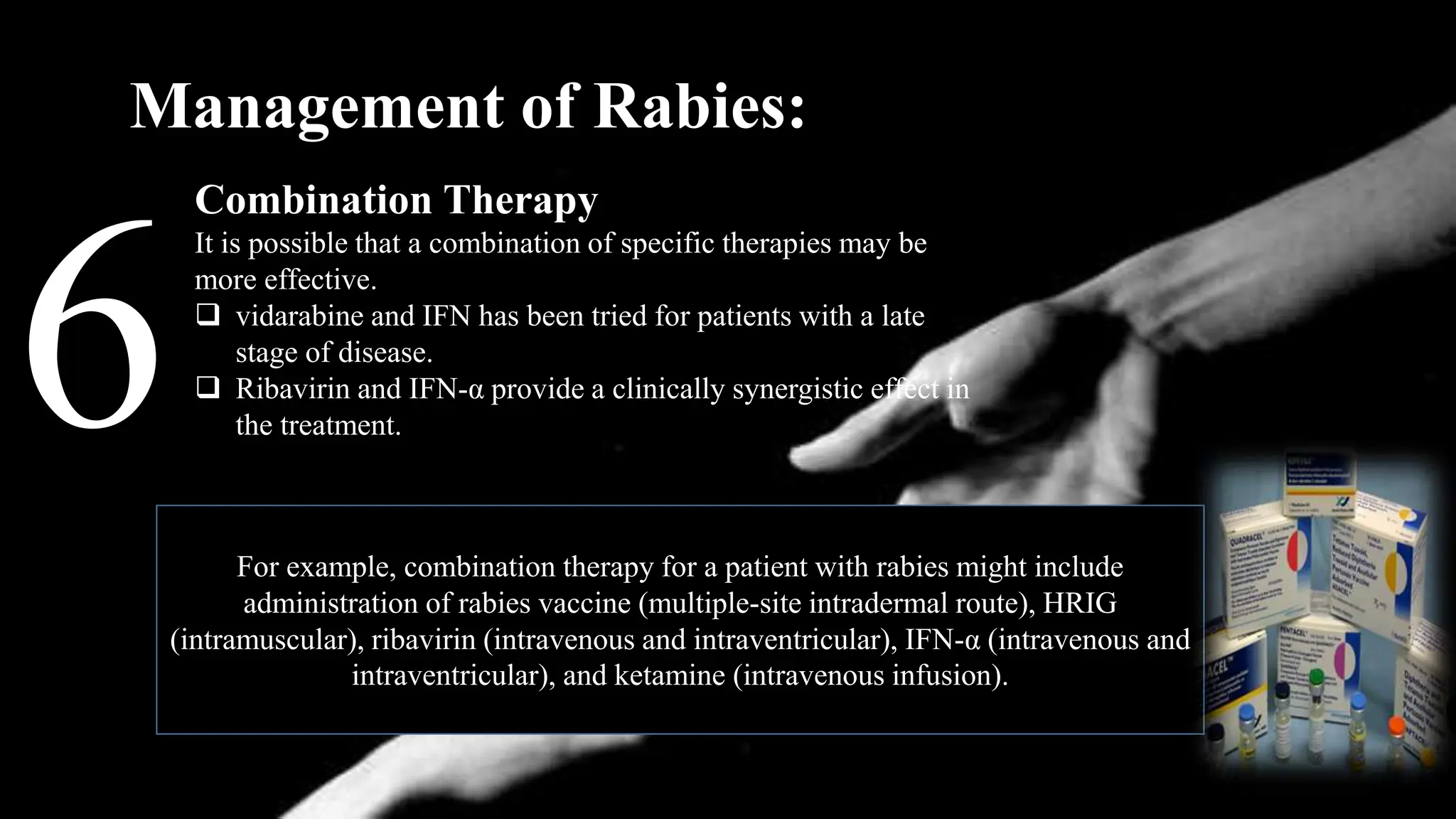 Rabies Clinical Disease Mangement By Waqas Siddiqe.pptx