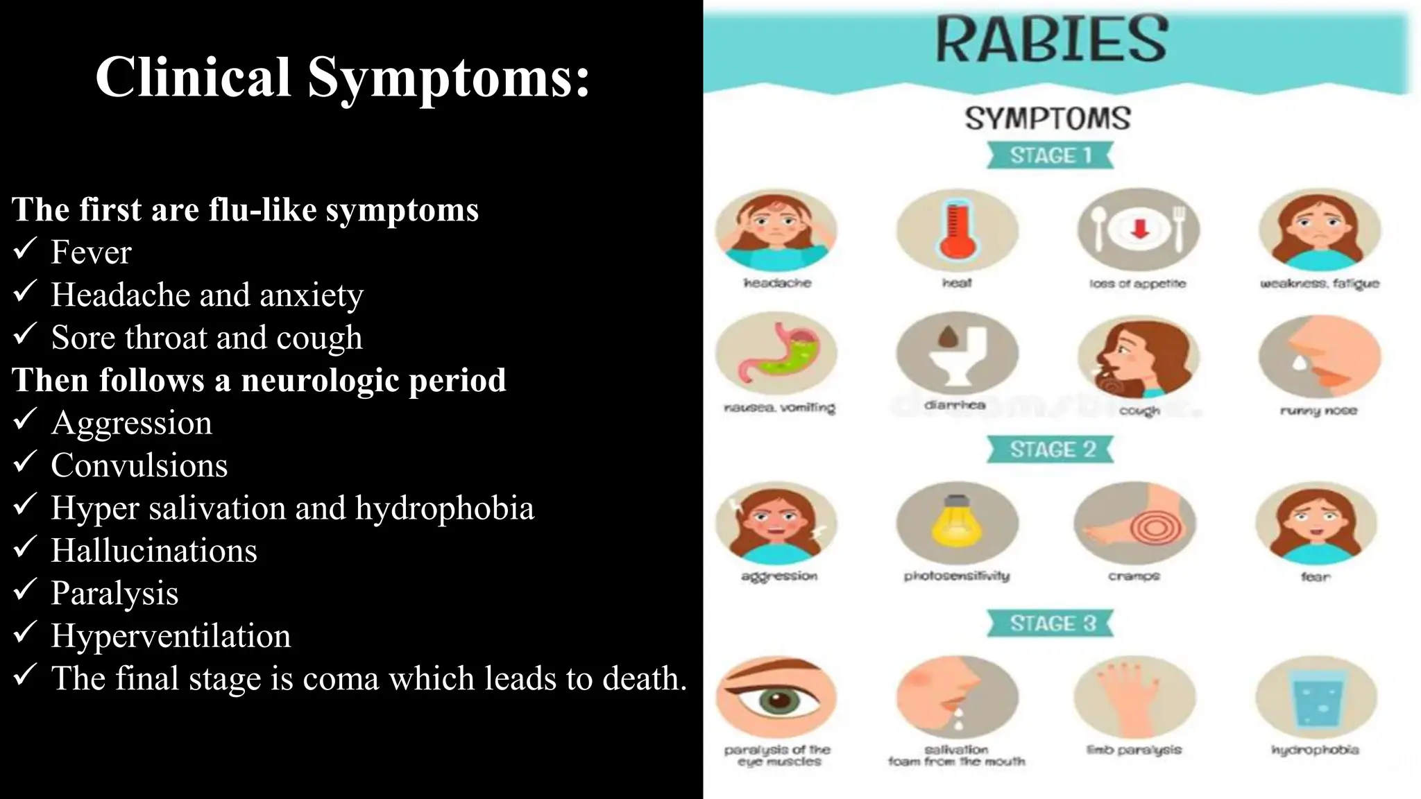 Rabies Clinical Disease Mangement By Waqas Siddiqe.pptx