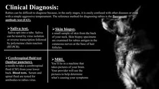 Rabies Clinical Disease Mangement By Waqas Siddiqe.pptx