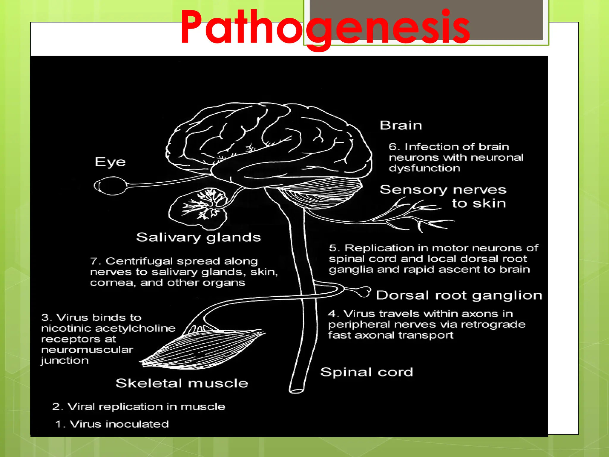 Rabies Pathology . Rabies causes treatment | PDF