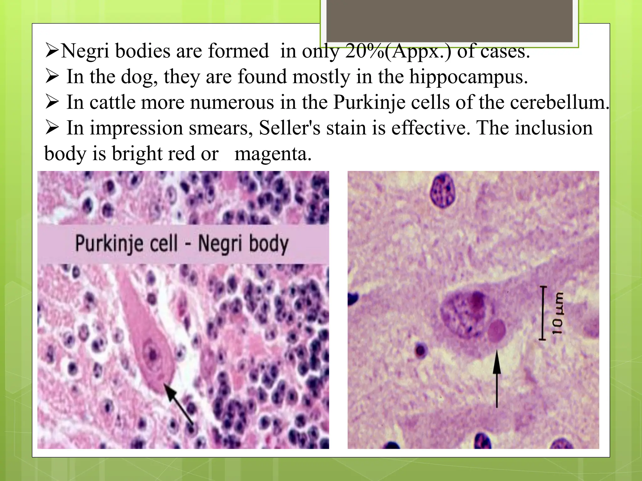 Rabies Pathology . Rabies causes treatment | PDF