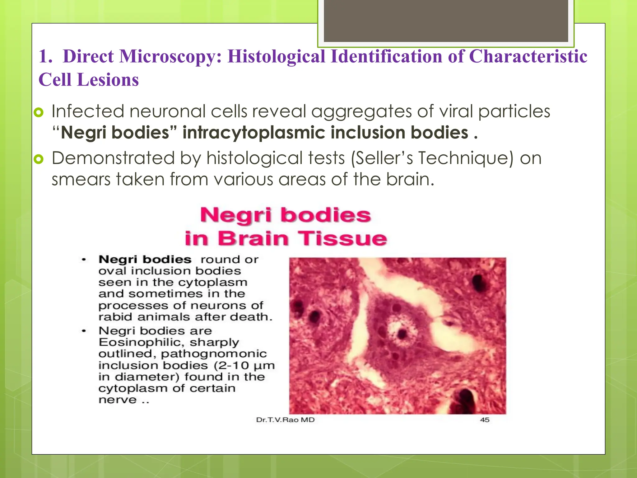 Rabies Pathology . Rabies causes treatment | PDF