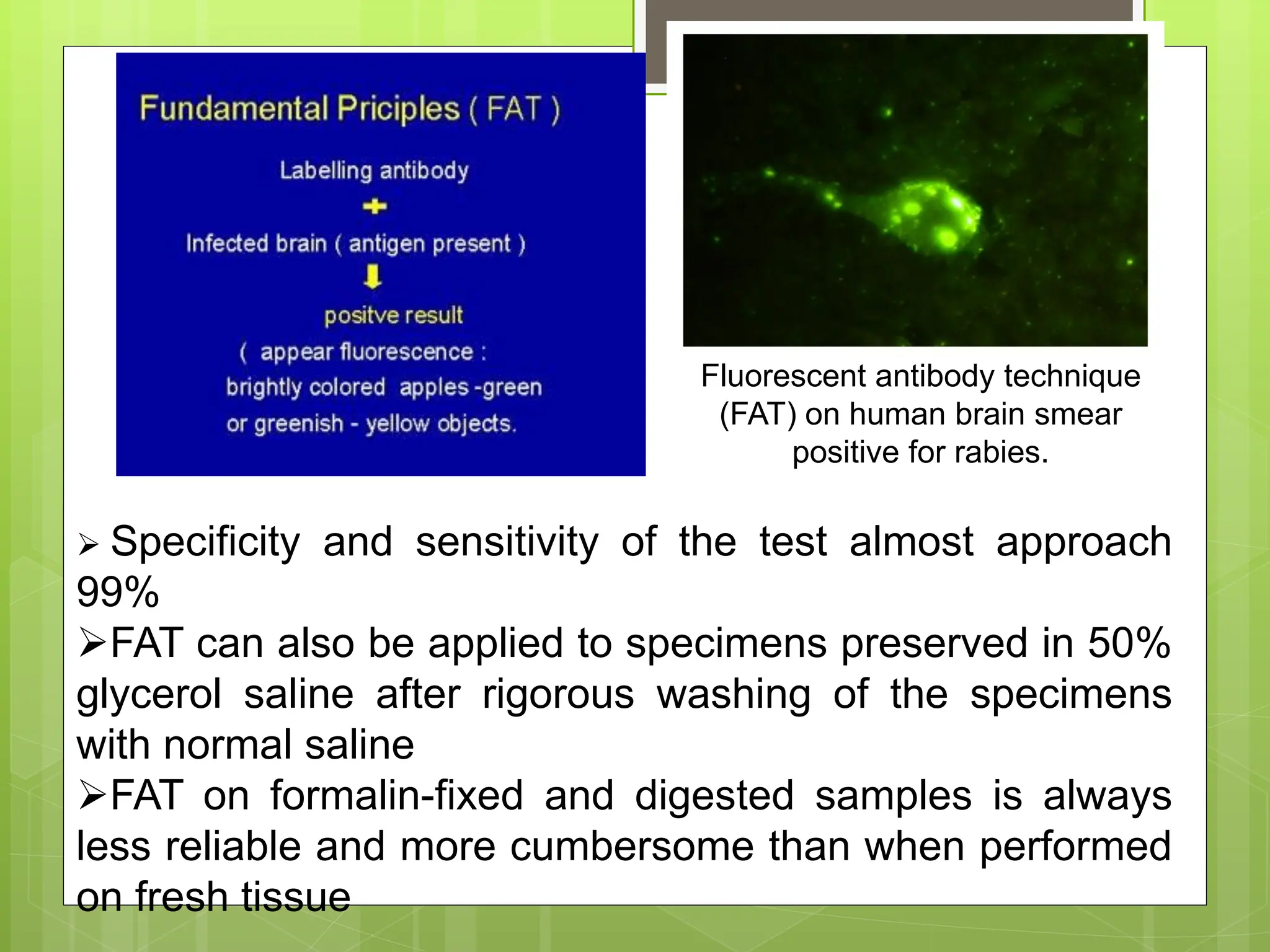Rabies Pathology . Rabies causes treatment | PDF