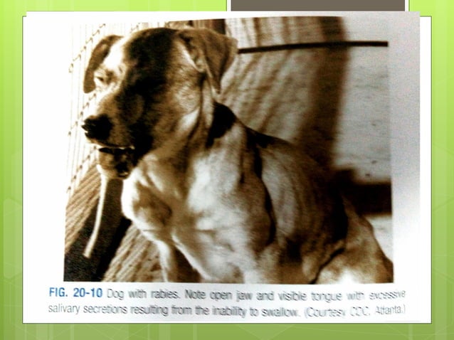 Rabies Pathology . Rabies causes treatment | PDF | Brain and Nervous ...