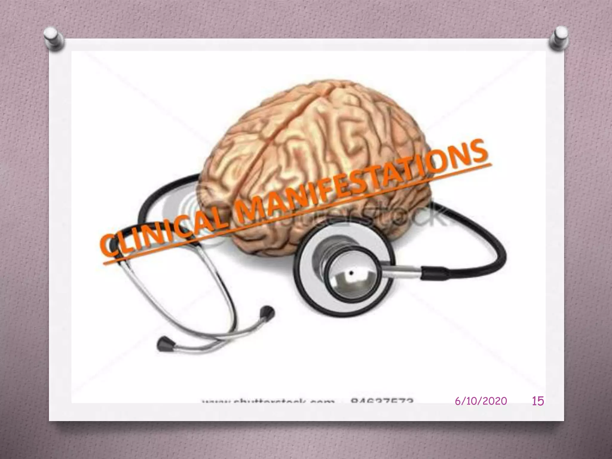 RABIES MANAGEMENT | PPTX