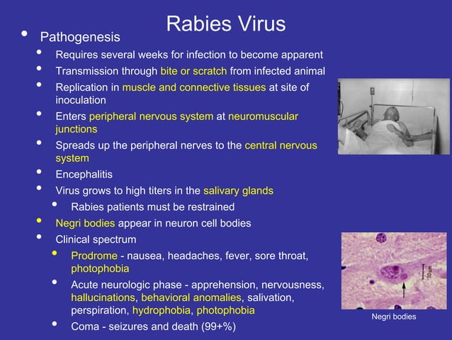 Rabies ppt.ppt | Infectious Diseases | Diseases and Conditions