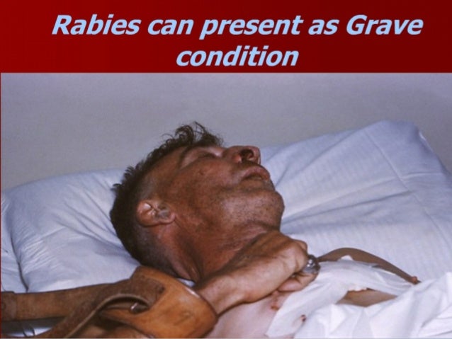 Rabies presentation