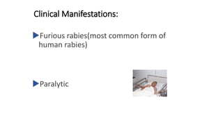 Rabies presentation for medical undergraduate students | PPTX